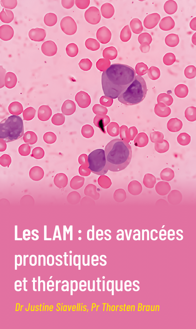 Les leucémies aiguës myéloïdes - Onko+